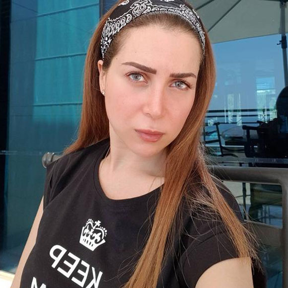 Découvrez May Ezzedine après sa rhinoplastie, en photo | Directinfo