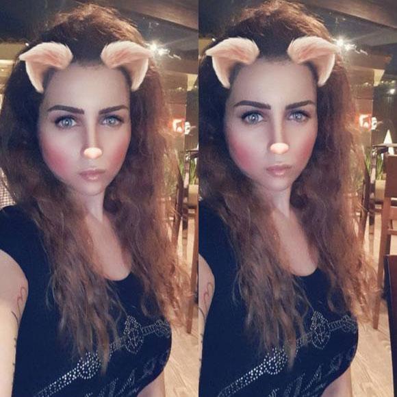 Découvrez May Ezzedine après sa rhinoplastie, en photo | Directinfo